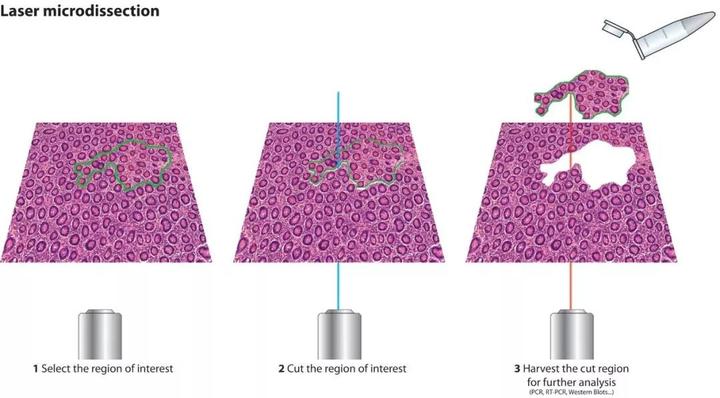 激光捕获显微切割 - 知乎