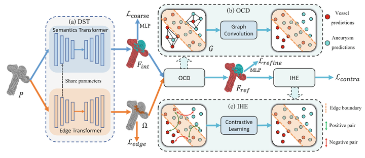 MICCAI2022 | 基于边缘点云变换的颅内动脉瘤三维分割算法 - 知乎