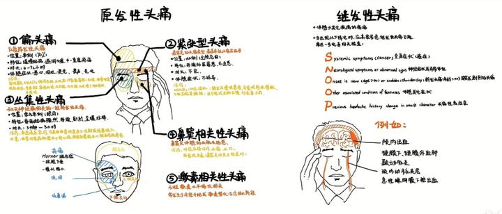 令人窒息的头痛，我该拿你怎么办？ - 知乎