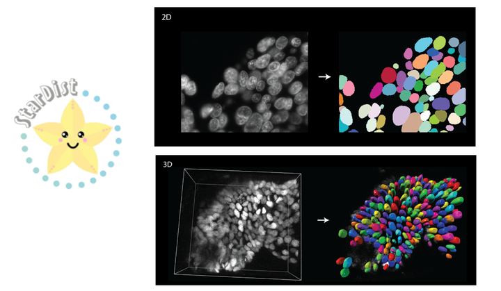 ImageJ实用教程——基于深度学习的细胞核自动分割（插件篇） - 知乎
