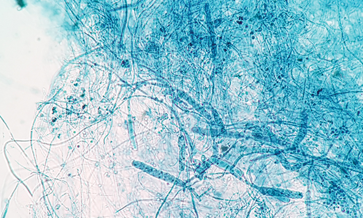 常见人宠共患病：皮肤癣菌病 - 知乎