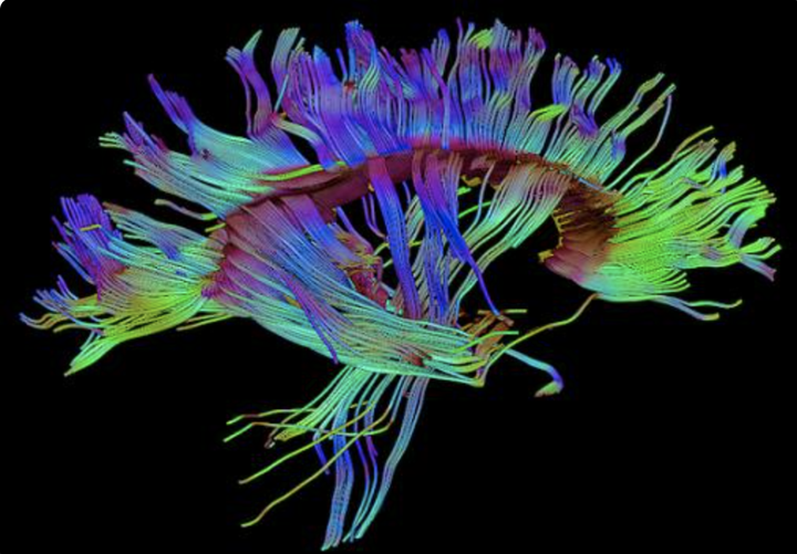 【Medical Imaging 01】 Diffusion Tensor Imaging (DTI) - 知乎